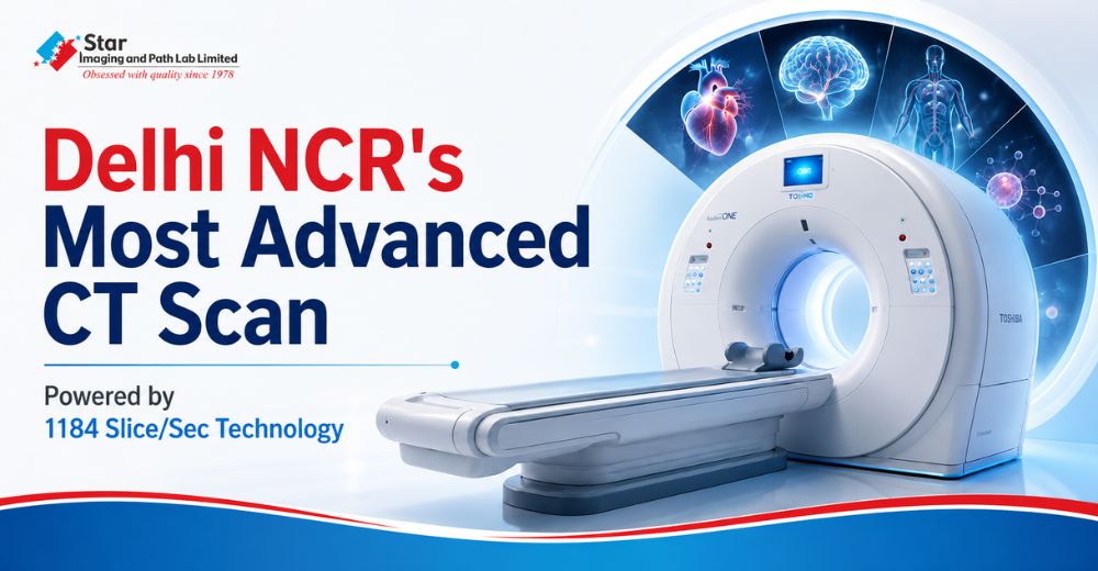 1184 Slice Cardiac & Whole Body CT Scan in Delhi